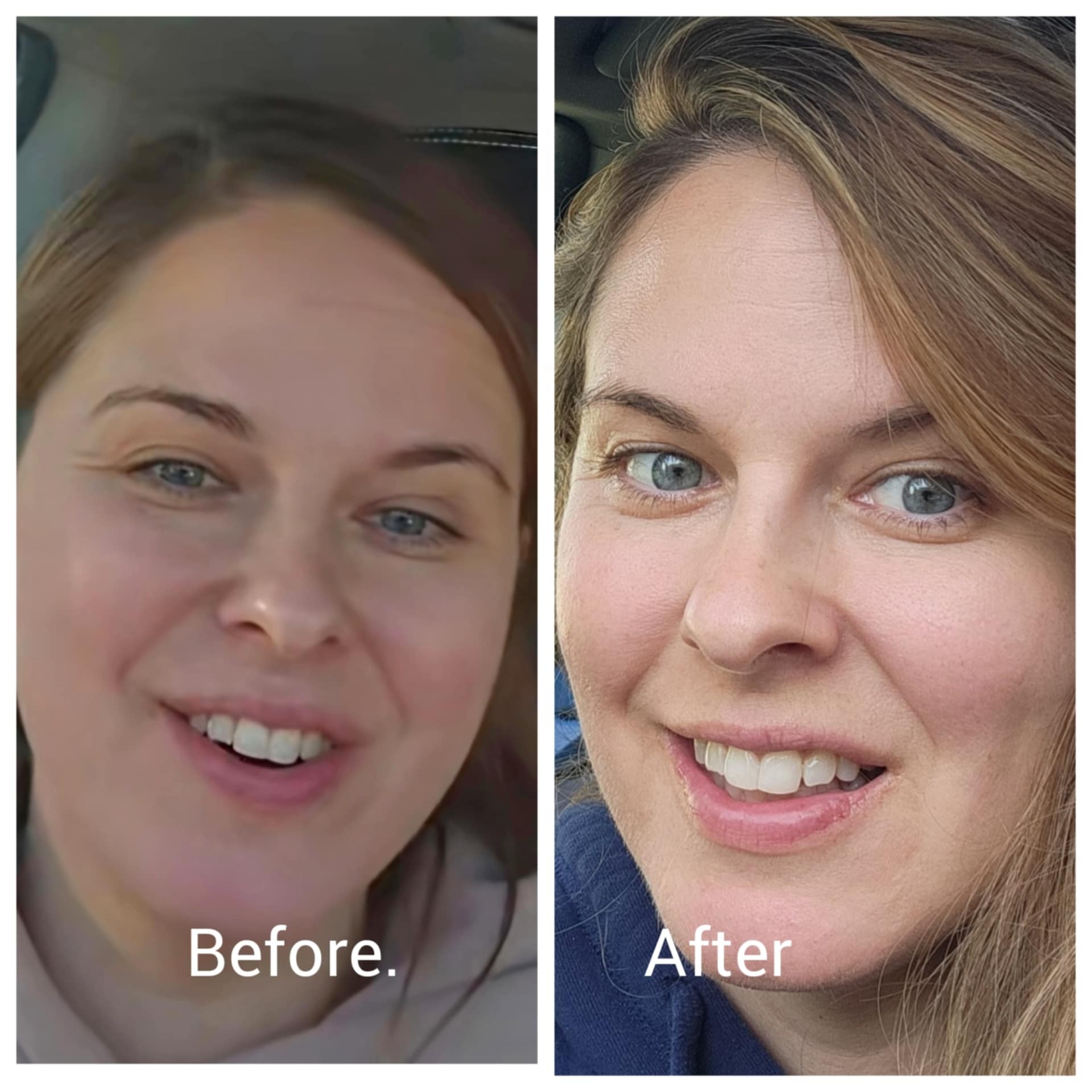 Chatgpt Request: Clean Skincare for Dry Skin - Grieve.Grow.Glow